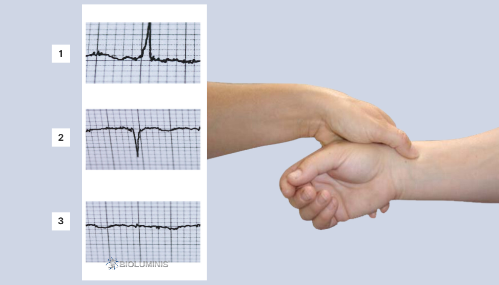 How is the pulse taken at Bioluminis? - Bioluminis®